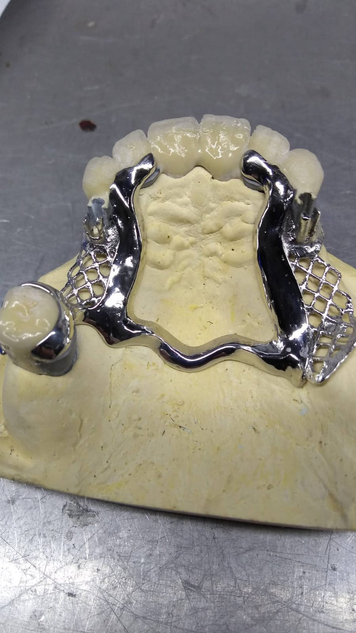 3D Printed CoCr Partial Frame – JMP